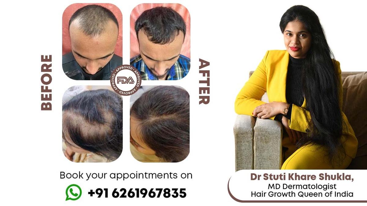 Meet Dr. Stuti Khare Shukla: The Hair Growth Queen Transforming Lives with Non-Surgical ...